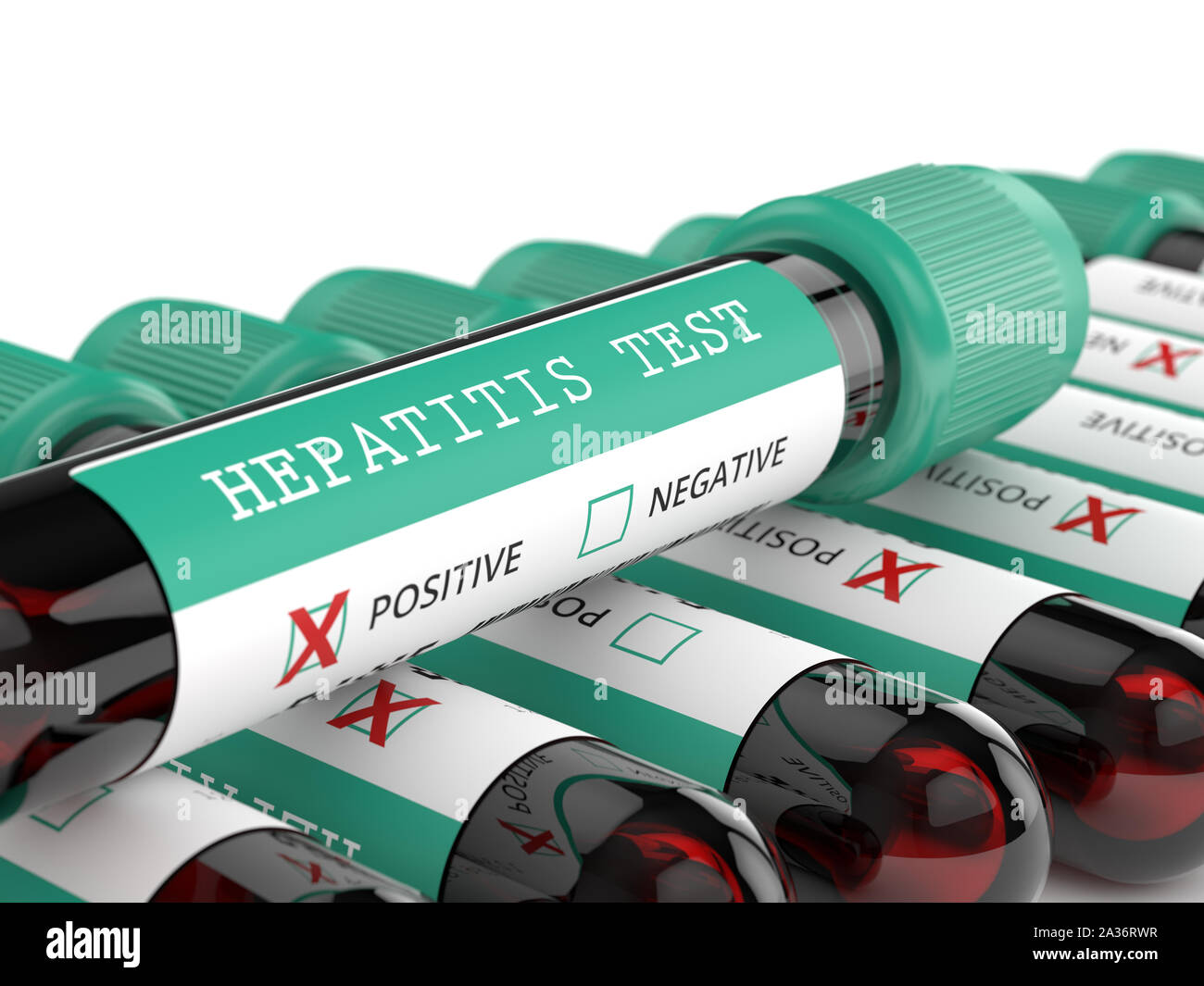 Hepatitis jaundice liver virus hi-res stock photography and images - Alamy