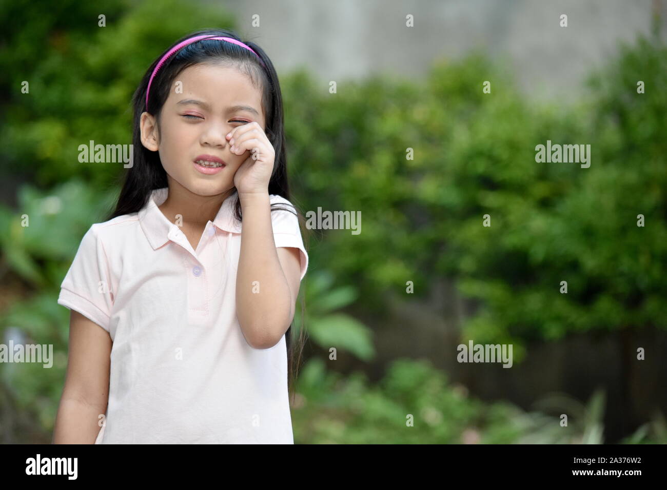 An An Allergic Girl Child Stock Photo - Alamy