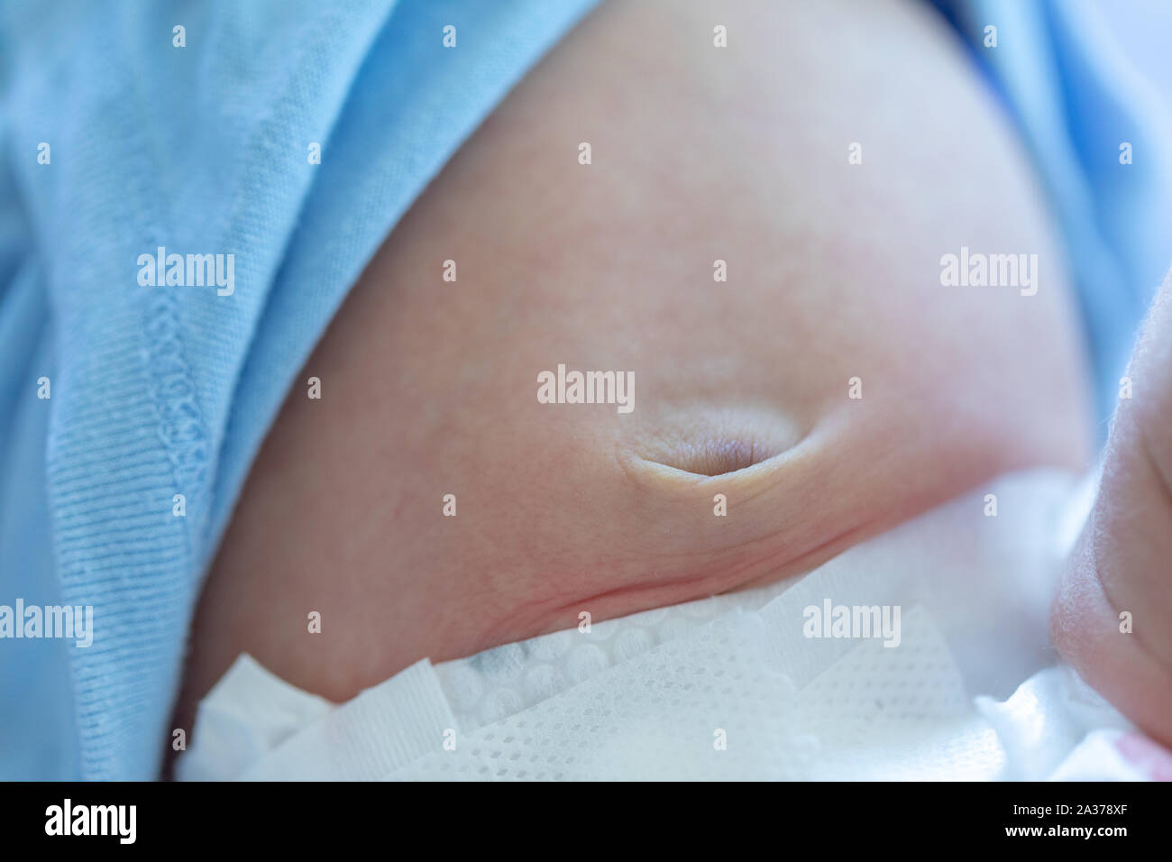 Navel boy hi-res stock photography and images - Alamy