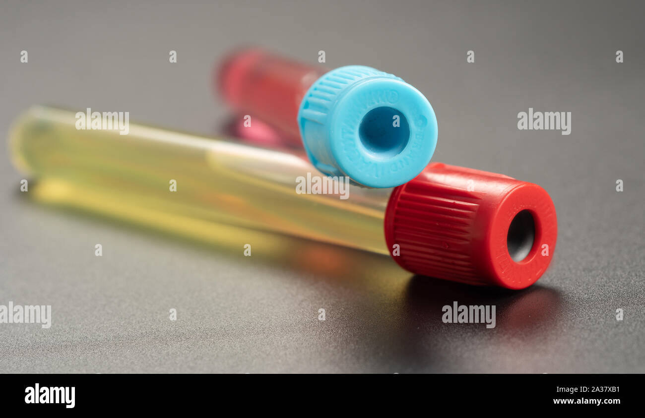 Test tubes with chemical samples in science laboratory Stock Photo - Alamy