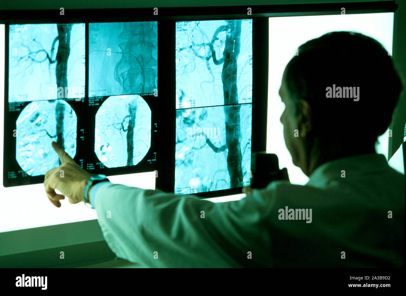 Brain neurons brain scan hi-res stock photography and images - Alamy