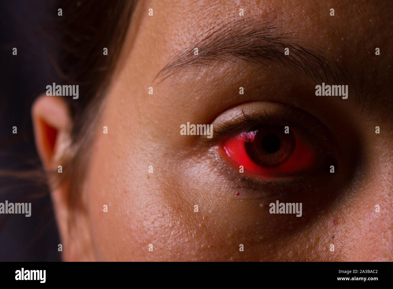 Aggravation after working at the computer. Red eye close up Stock Photo ...