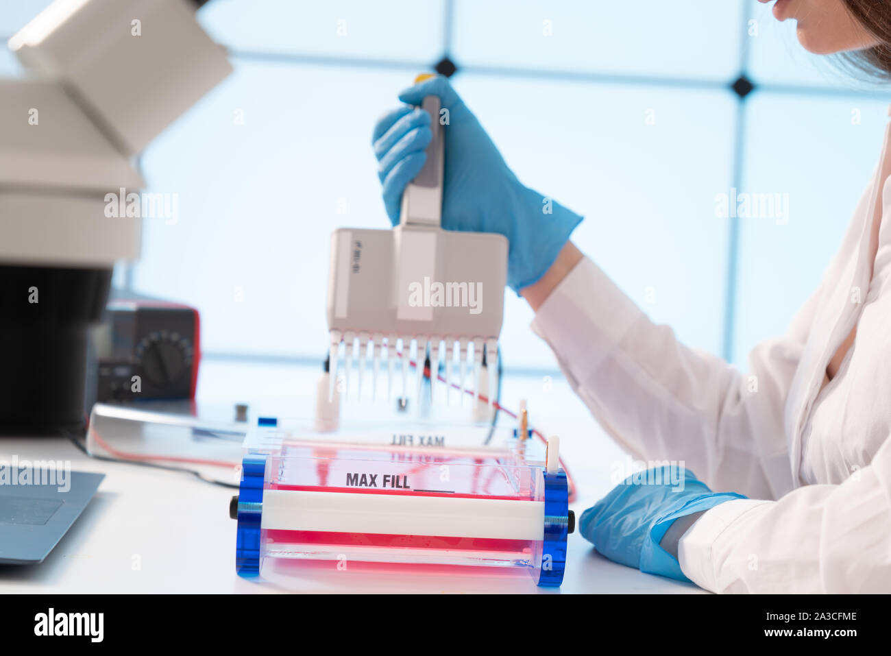 Blood Test Electrophoresis Procedure at Carl Atkins blog