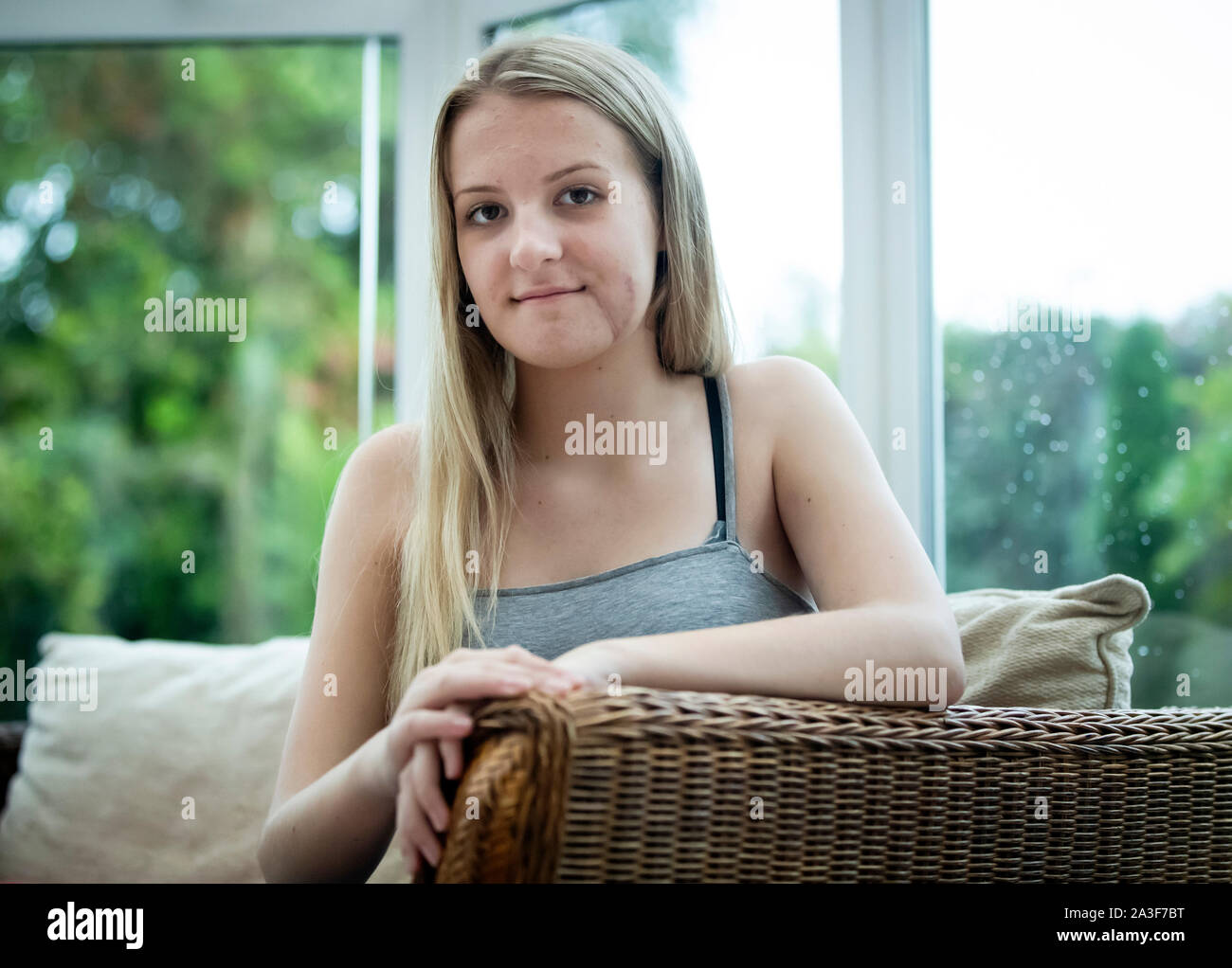 Emily Eccles, at her home in Yorkshire, after she suffered one of the ...