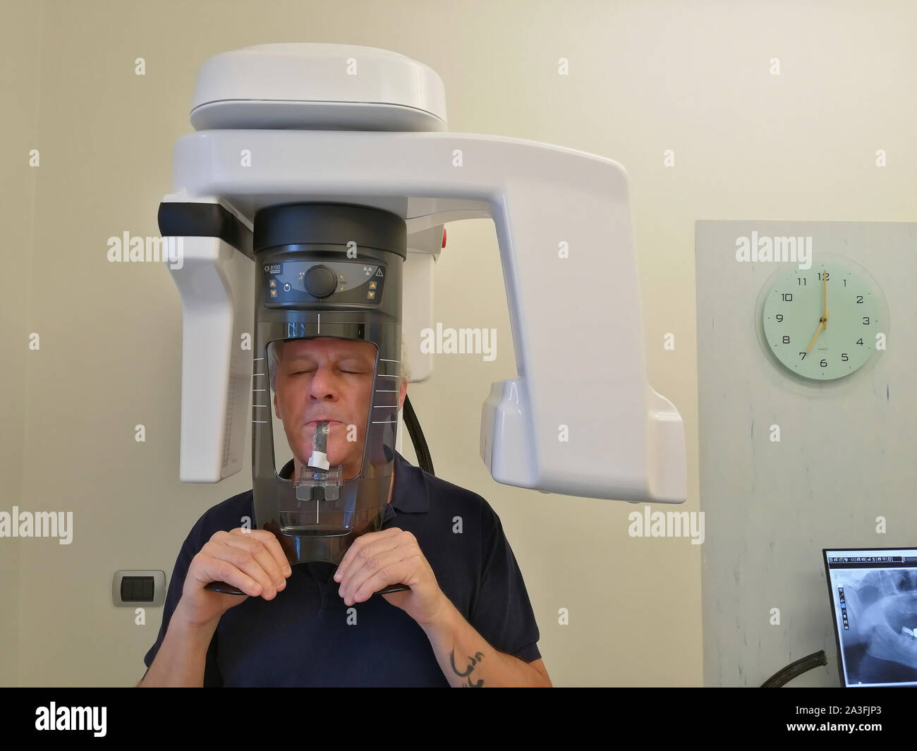 Panoramic Radiography Dental Definition at Cameron Kopsen blog