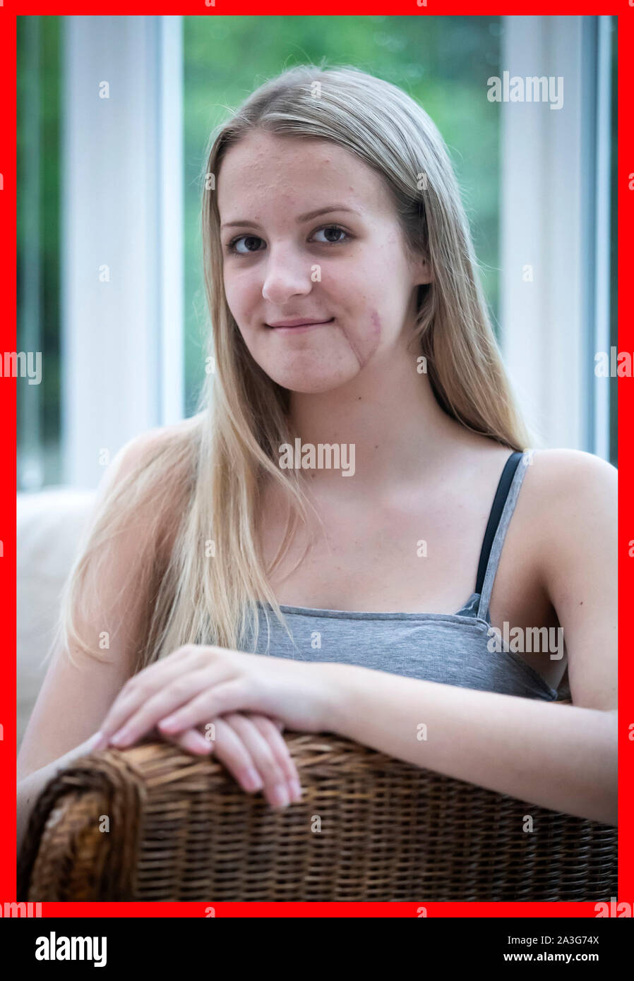 Emily Eccles, at her home in Yorkshire, after she suffered one of the ...