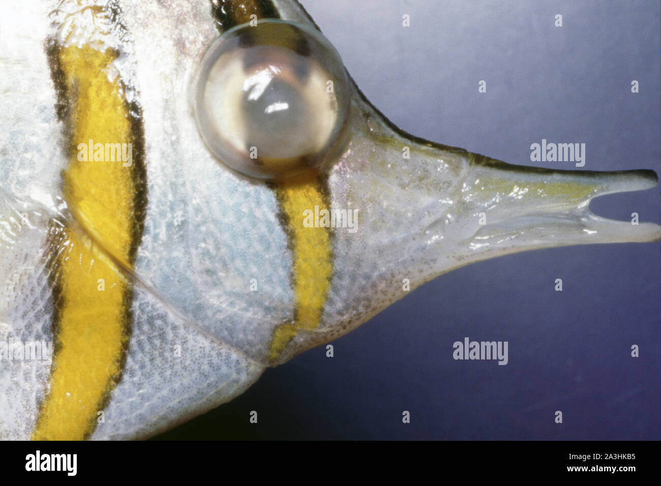 Exophthalmos hi-res stock photography and images - Alamy