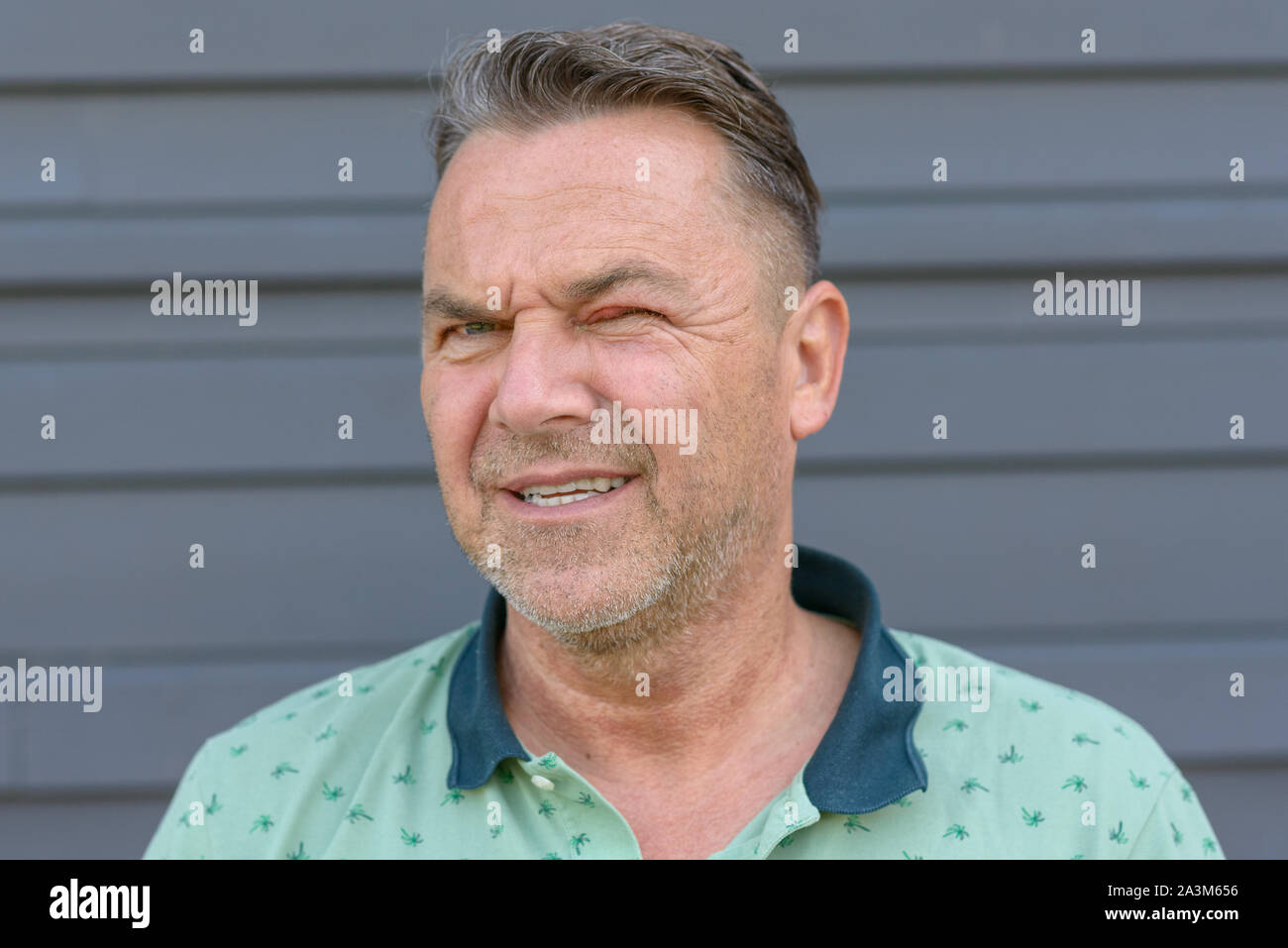 Man with an inflamed eye due to a bacterial infection of the upper ...