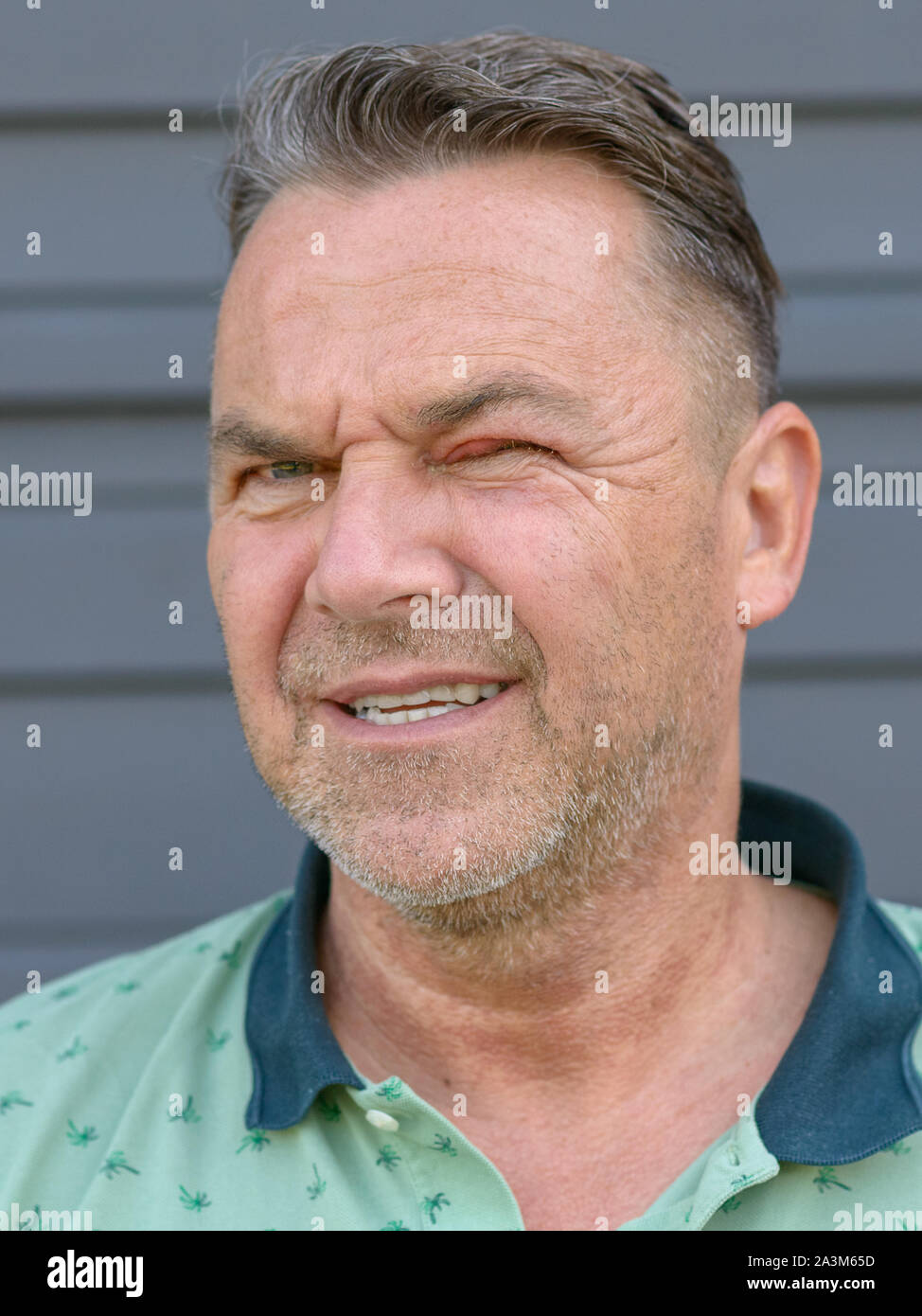 Portrait of an man with an inflamed eye due to a bacterial infection of ...