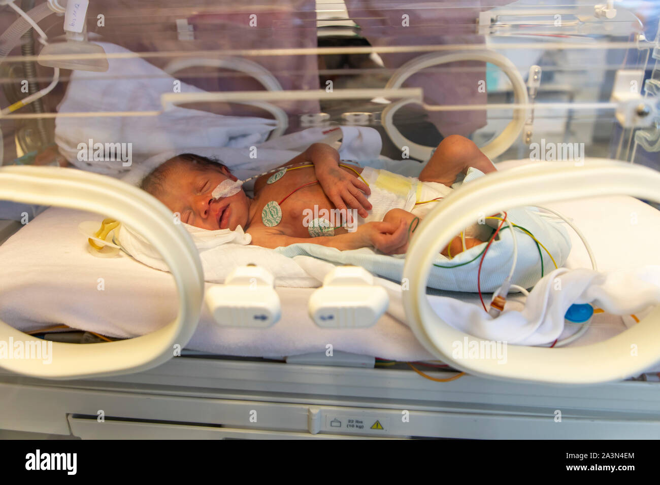 Premature birth hi-res stock photography and images - Alamy
