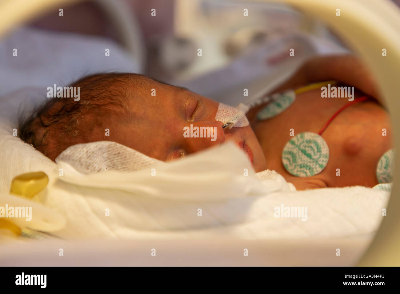 Premature birth ward in a hospital, neonatology department, premature ...