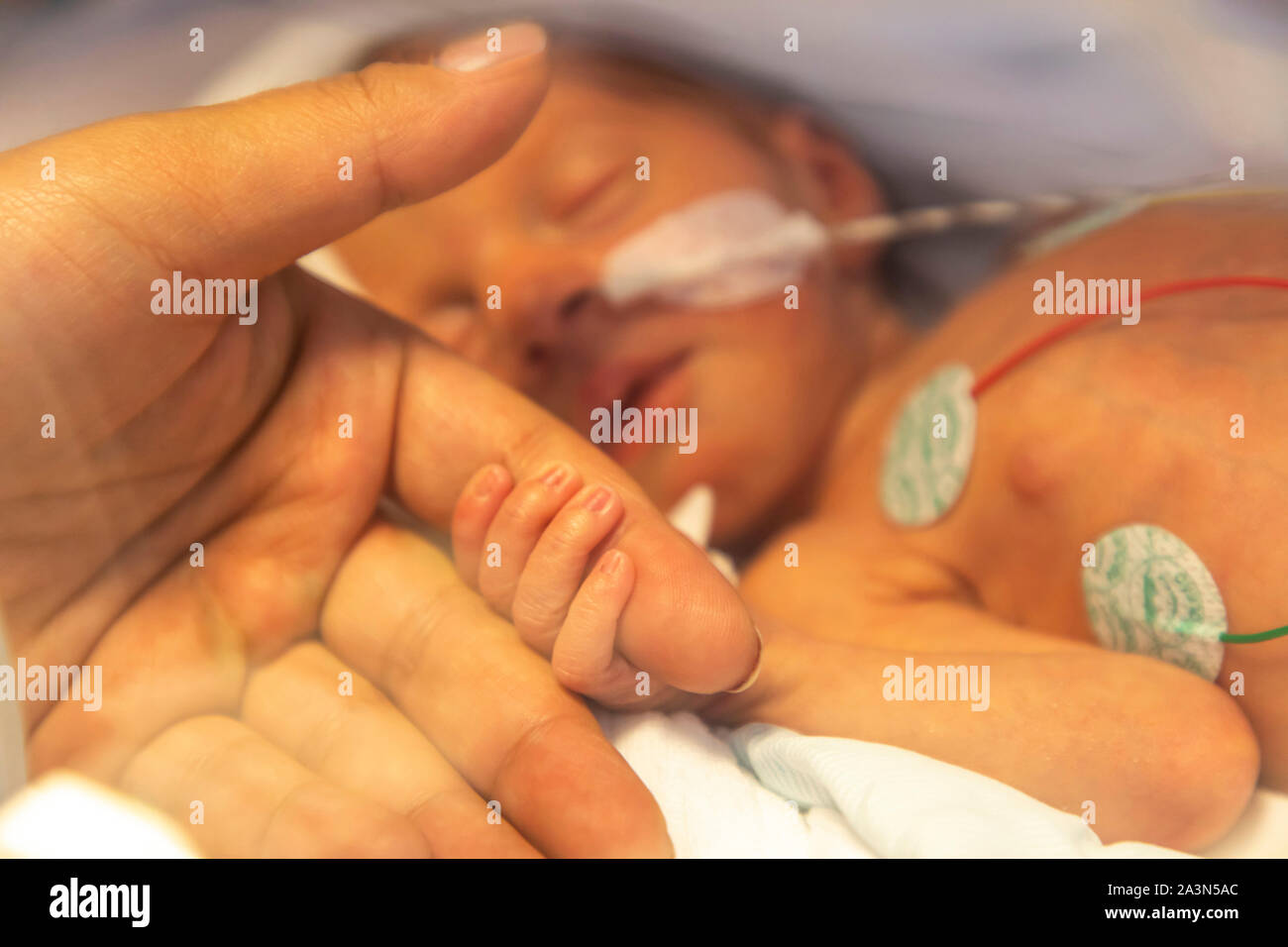 Premature birth ward in a hospital, neonatology department, premature ...