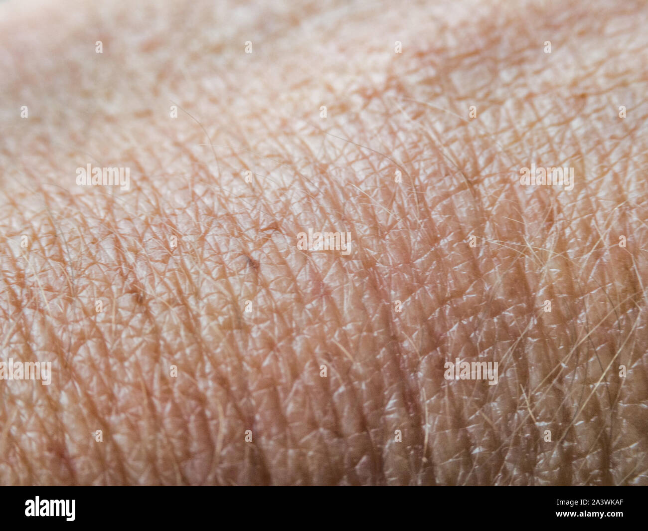 Skin macro hi-res stock photography and images - Alamy