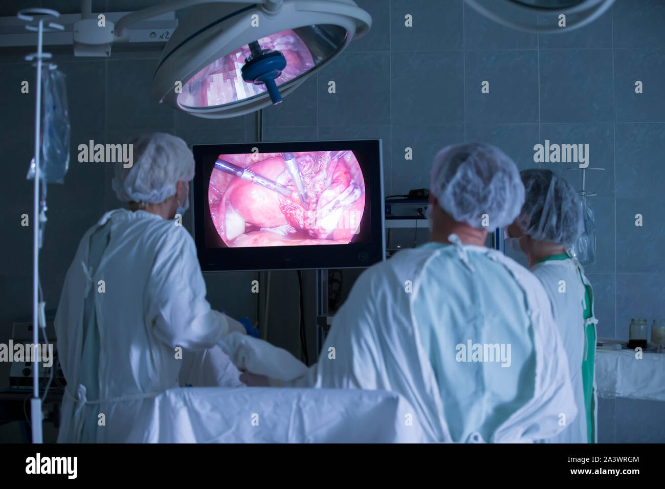 Laparoscopy hi-res stock photography and images - Alamy