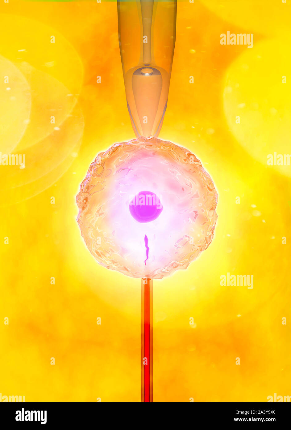 Artificial or assisted fertilization is the process by which the union ...