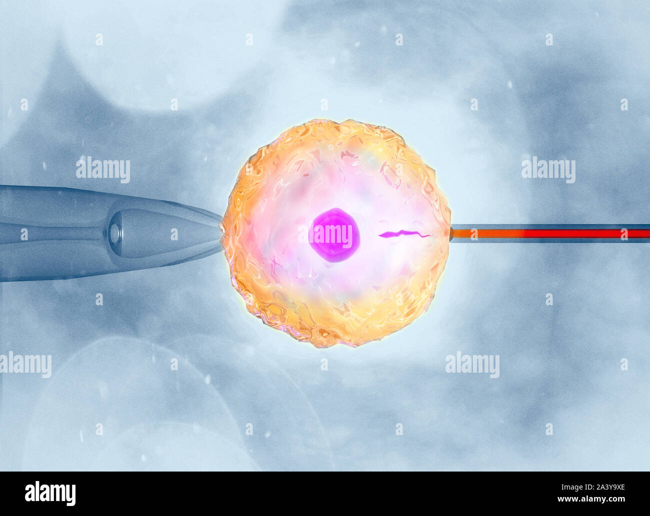 Artificial or assisted fertilization is the process by which the union ...