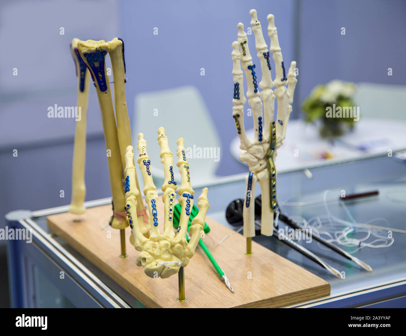 Traumatology / osteosynthesis surgery bone Locking Plates system Stock ...