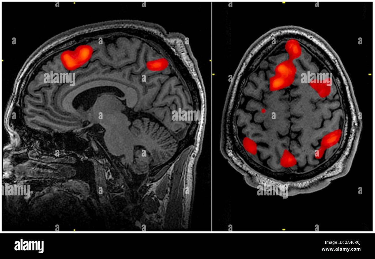 Fmri scan during working memory tasks hi-res stock photography and ...
