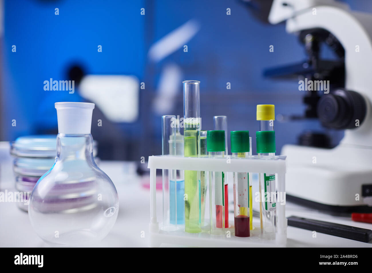Close up of assorted glassware and test tubes with blood samples on ...