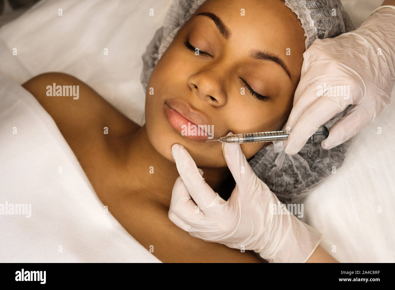 Injections of the lips. Correction of the shape of the lower lip ...