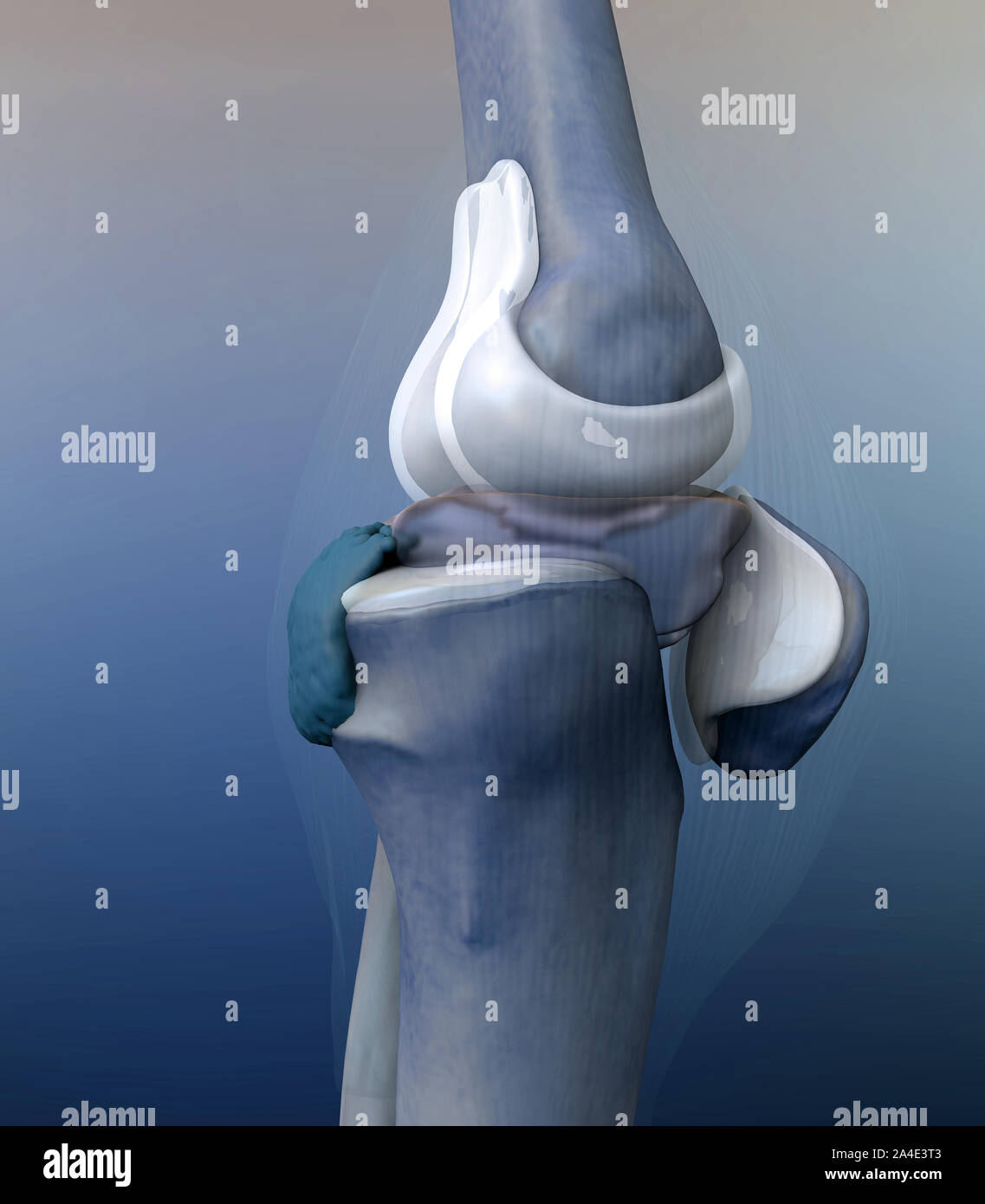 pain illustration knee side, 3d illustration knee side, Knee x-ray ...