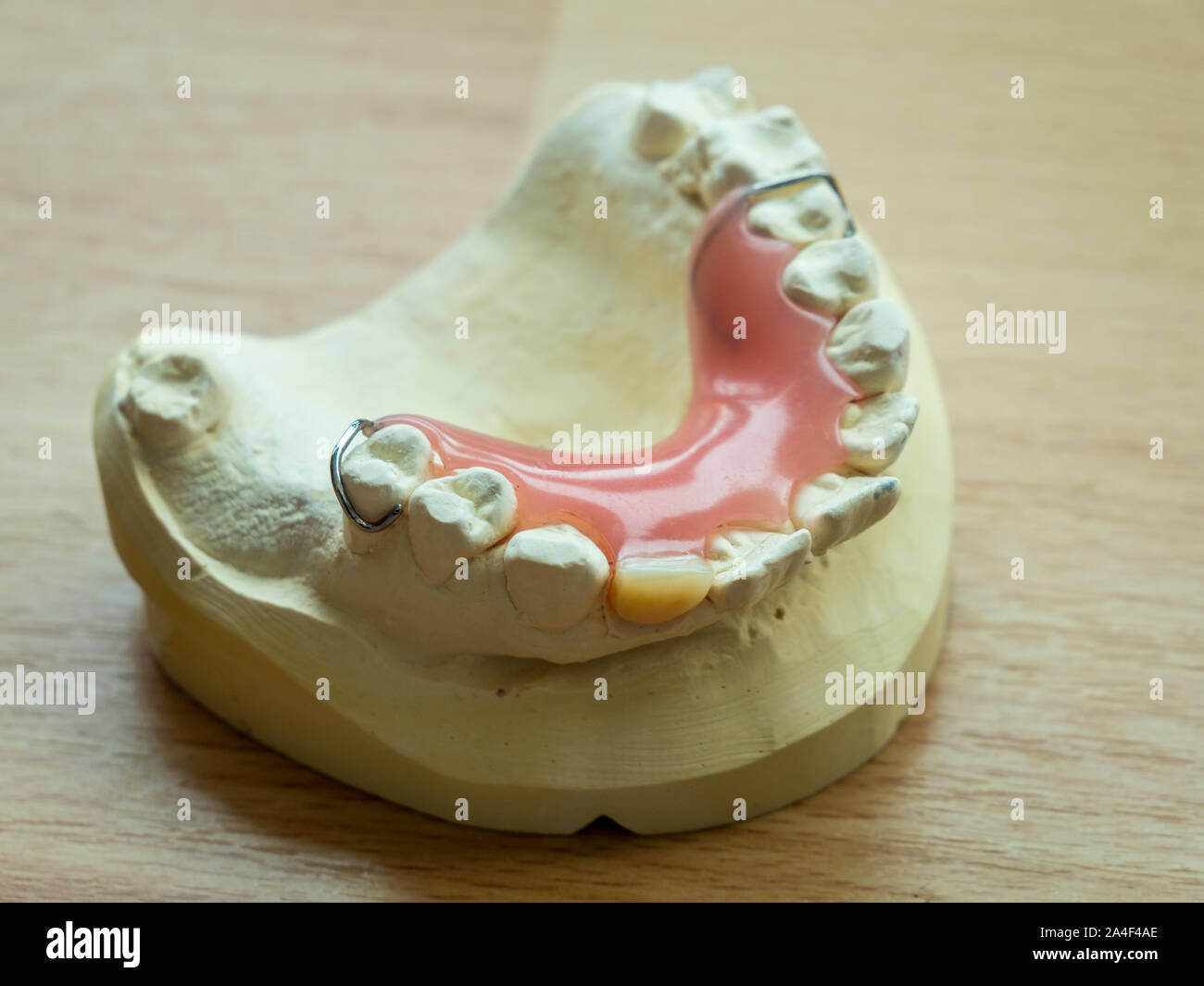 Tooth prosthesis isolated Stock Photo - Alamy