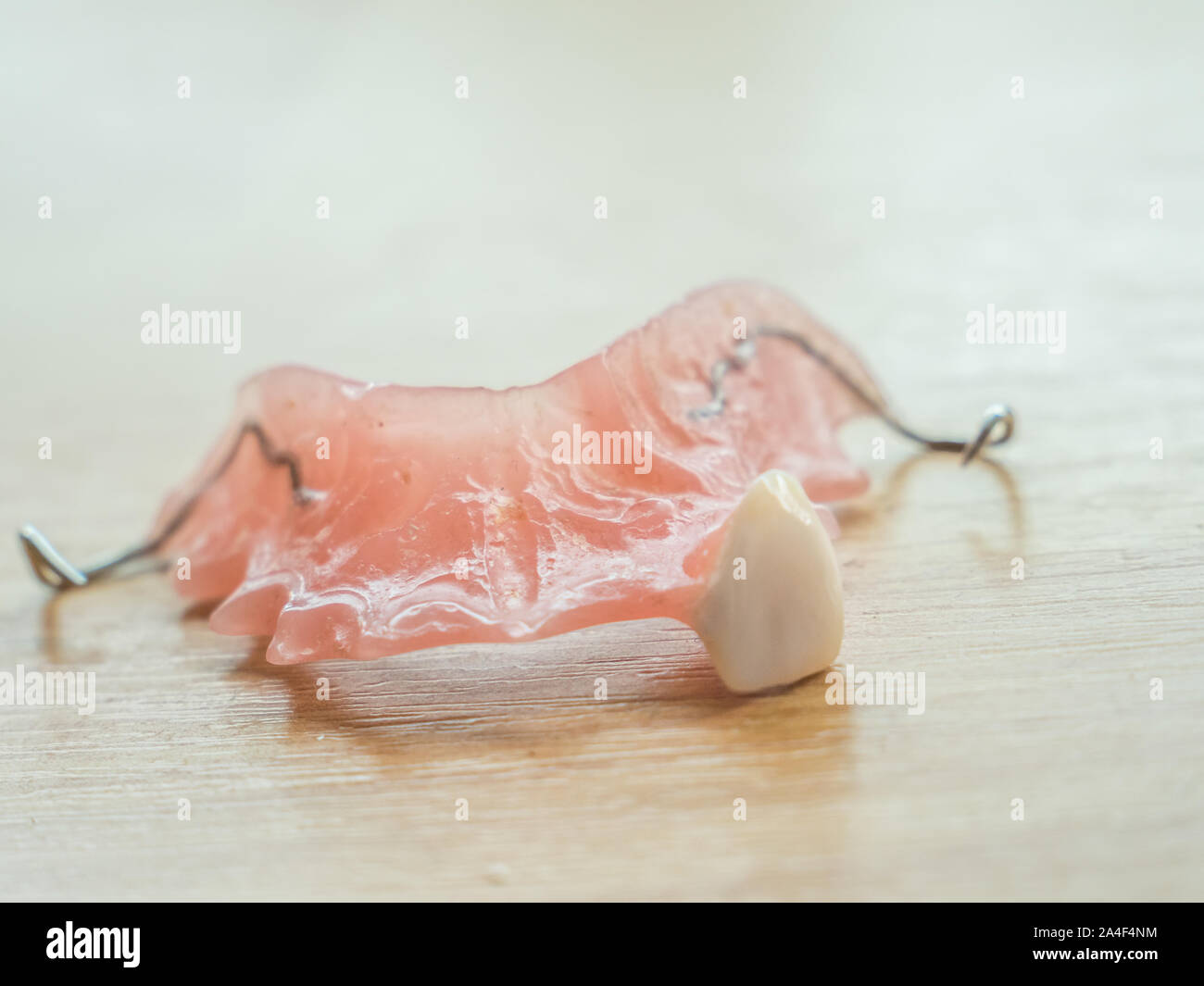 Tooth prosthesis with one tooth Stock Photo - Alamy
