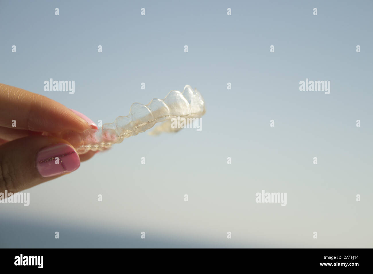Teeth splint for correction of dental position Stock Photo - Alamy