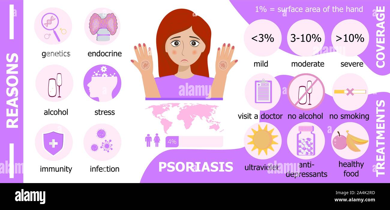 Psoriasis infographics. Reasons and treatments and coverage are shown ...