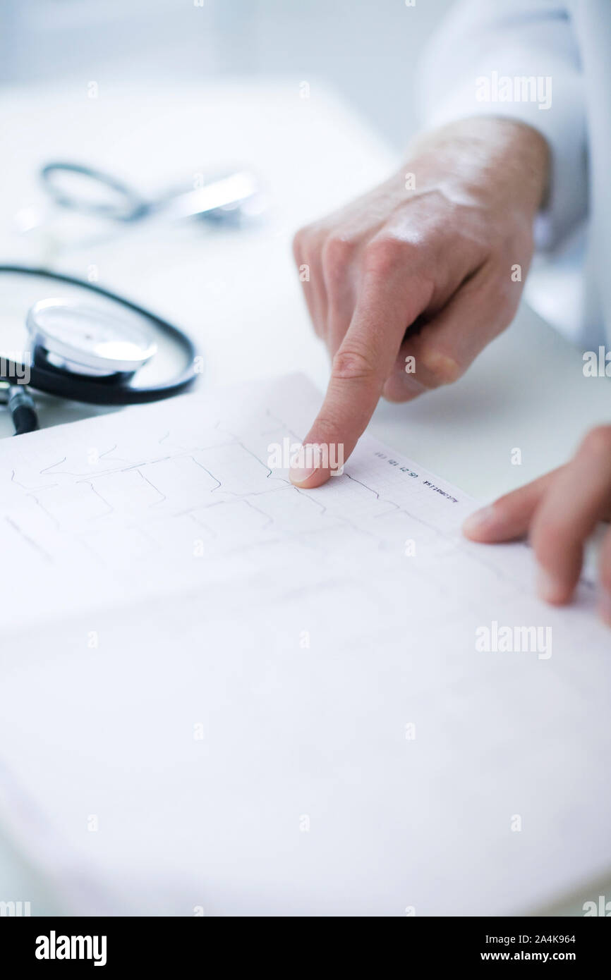 Doctor's office hours - explaining - Doctor at hospital with ECG chart ...
