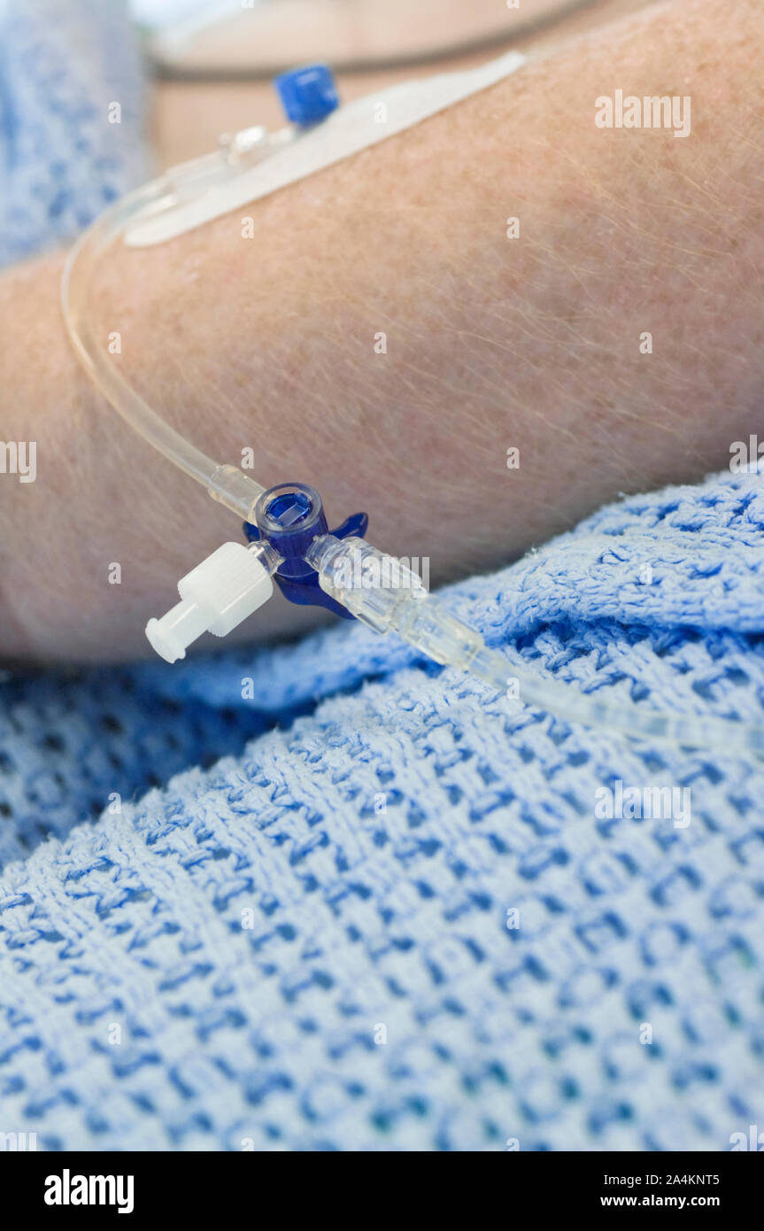 Patient's arm with equipment for intravenous injections Stock Photo - Alamy