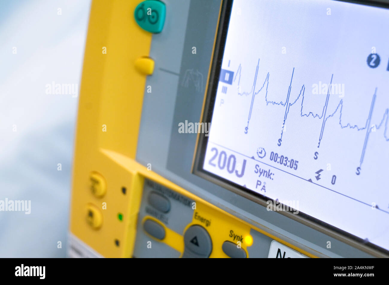 Cardiac monitor. Heart monitor. Monitor measuring heartbeats. Emergency ...