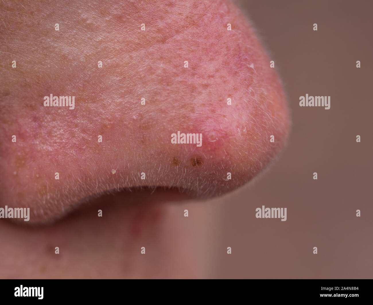 Red nose and doctor hi-res stock photography and images - Alamy