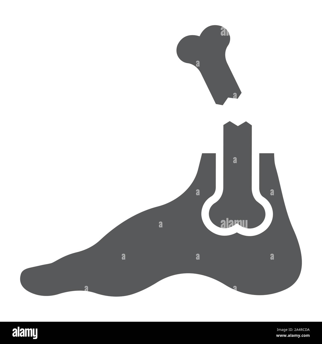 Leg cast black and white hi-res stock photography and images - Alamy