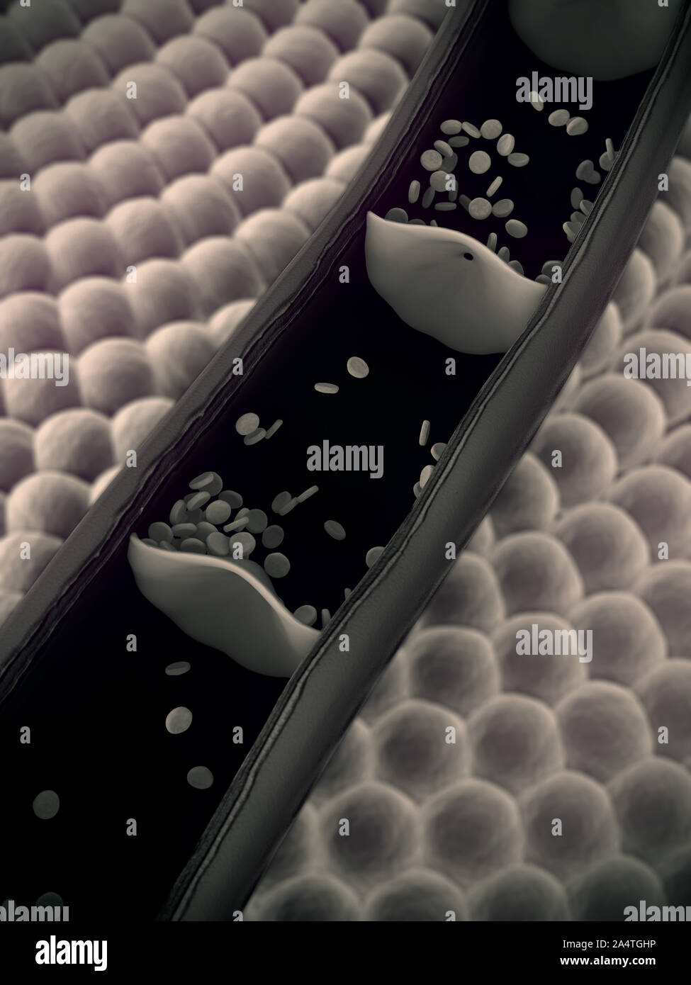 Contraction of blood vessels, fat cell in the blood, inside the blood ...