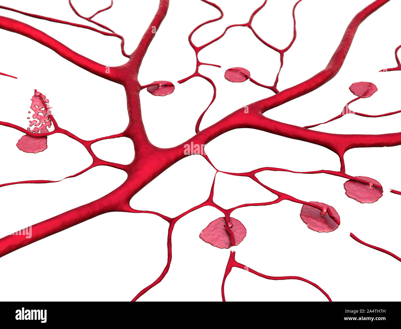 3D illustration of circulatory system, disease, of Capillary, blood ...