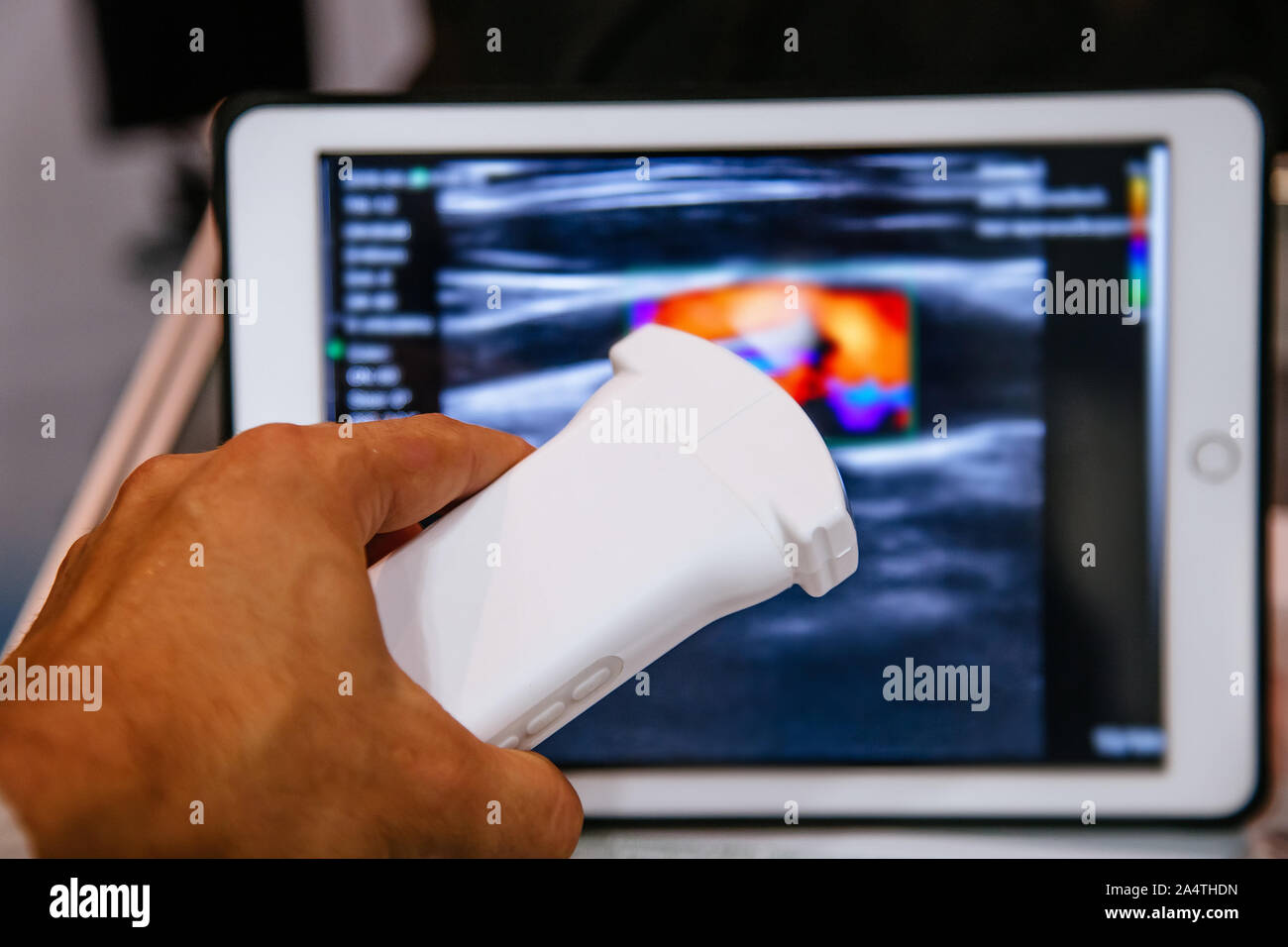 Modern portable ultrasound machine in clinic laboratory of sonography ...