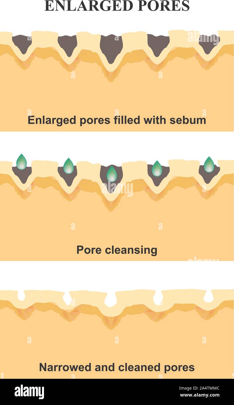 Microscopic Skin Pores