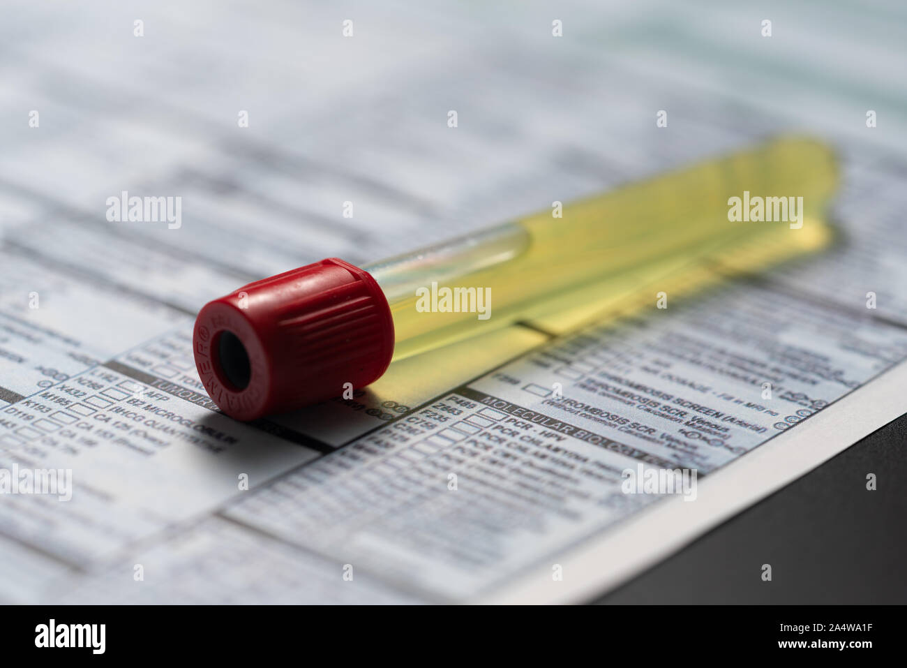 Water for chemical and microbiology analysis in lab Stock Photo - Alamy