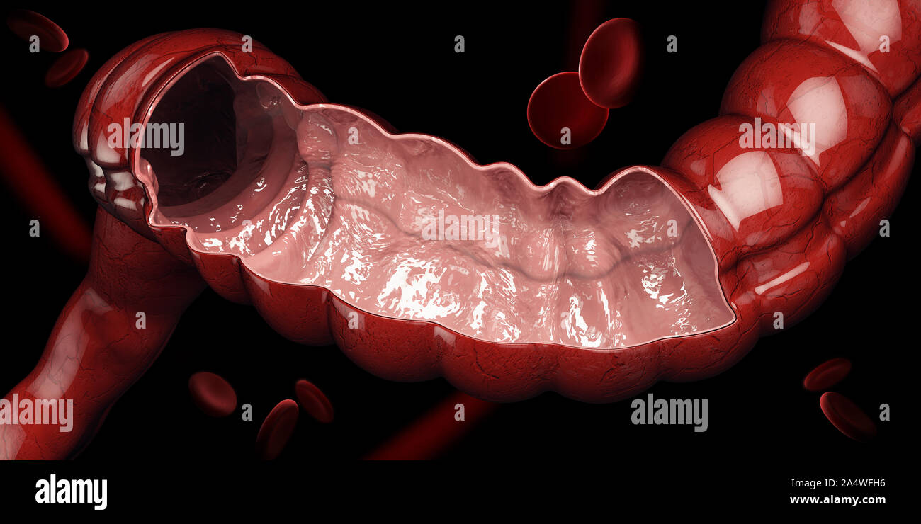 3d illustration of colon, intestine, digestive system, Human Anatomy ...