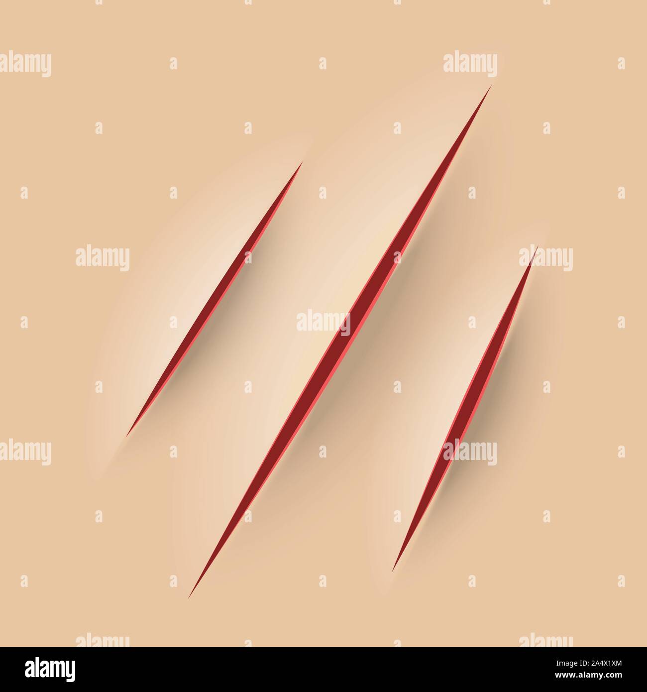 Scratch on skin. Red blood. Razor cut vector illustration. Realistic ...