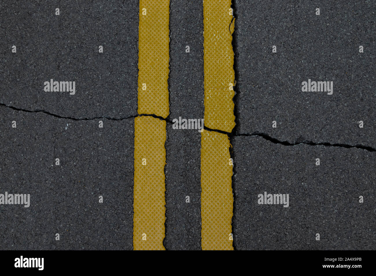 Closed fracture hi-res stock photography and images - Alamy