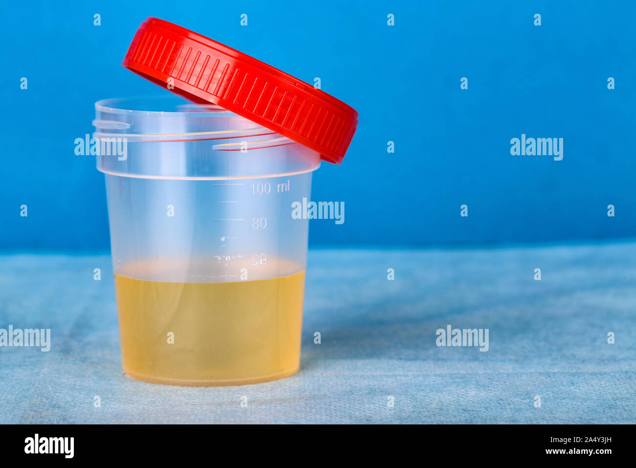 The Plastic container with urine analysis Stock Photo - Alamy