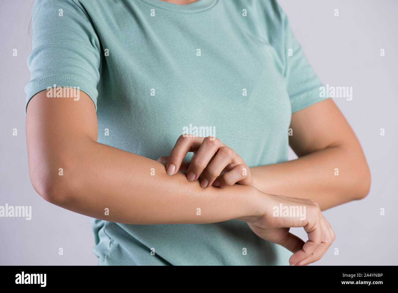 Close up woman arm scratch the itch by hand at home. Healthcare and ...