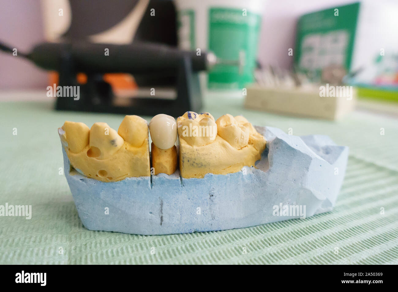 dentist examines artificial dental crowns on a model in his office ...