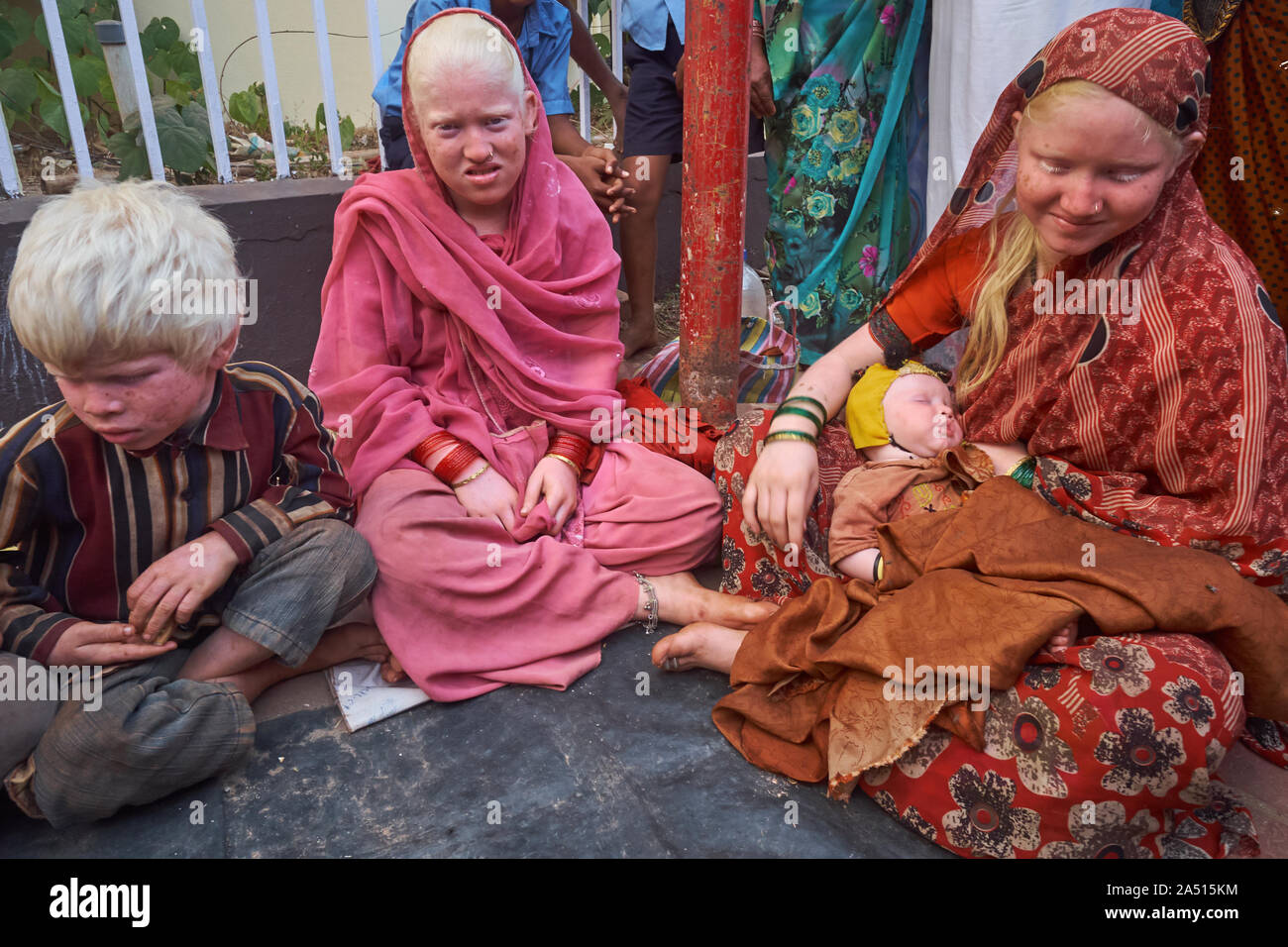 Albino Indian Family British Family Who Have 15 Albino Members Reveal