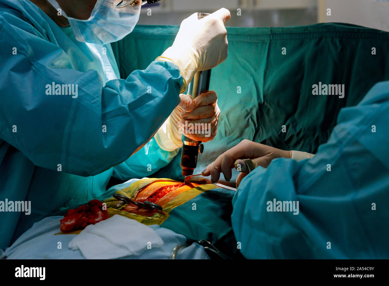 Preparation of surgical operation with a cut in the hands of assistant ...