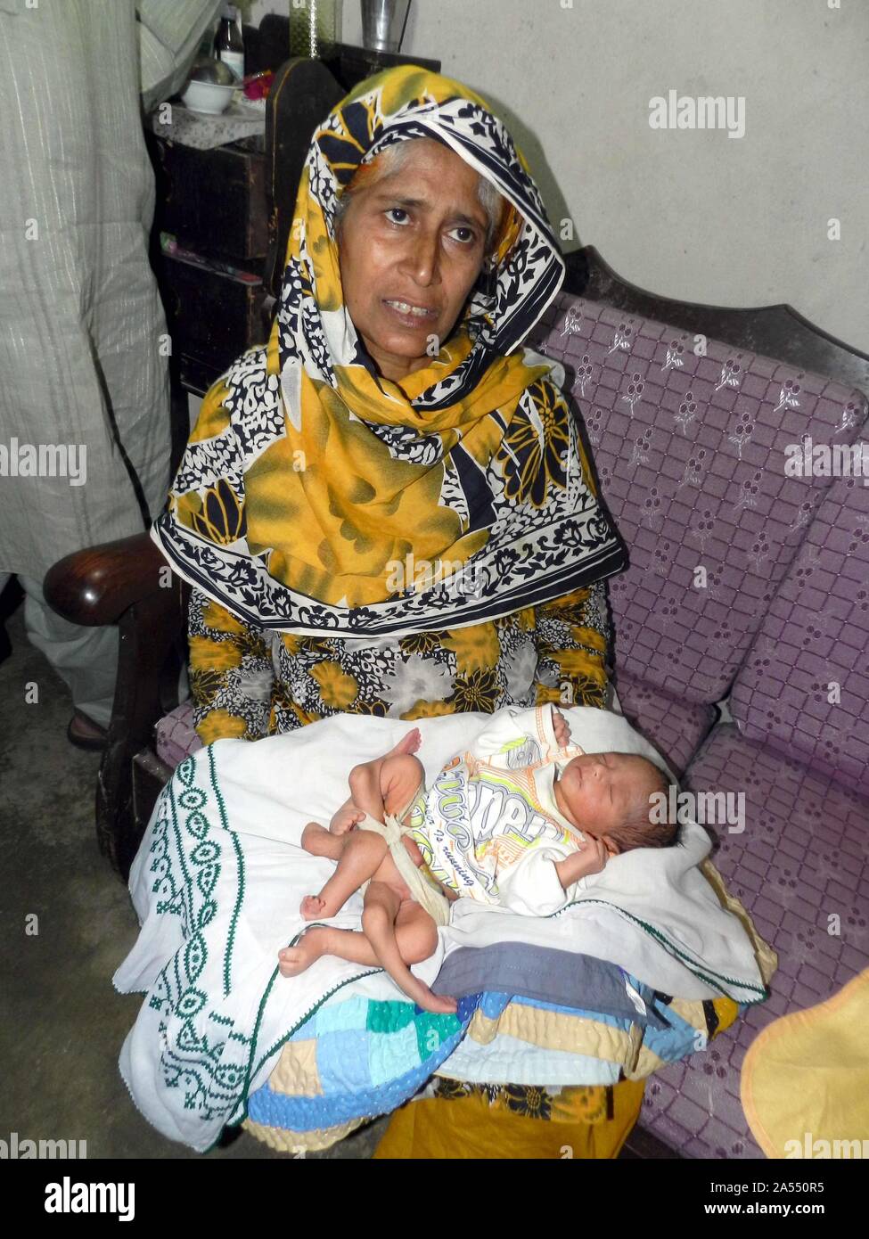 A six legged infant child born in Sukkur few years ago, being treated ...