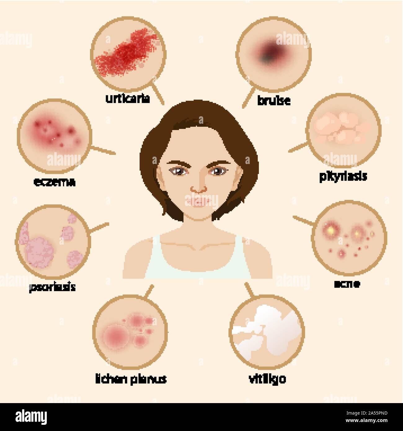 Diagram showing different sickness illustration Stock Vector Image ...