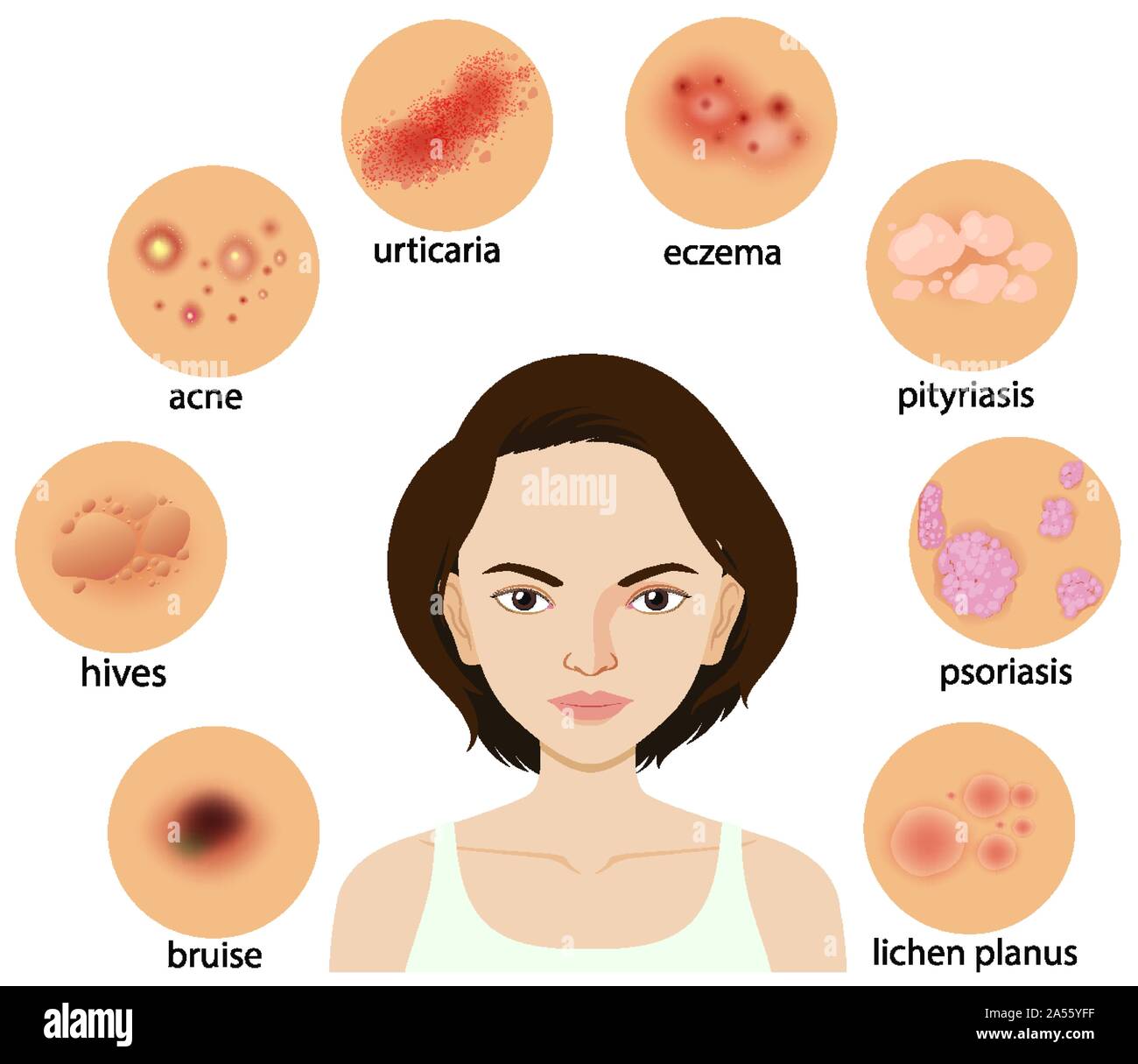 Diagram showing different skin conditions illustration Stock Vector ...
